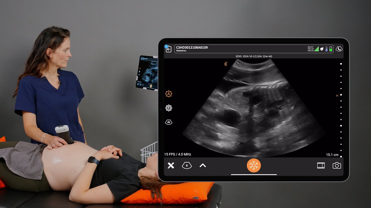 3rd Trimester Biophysical Profile