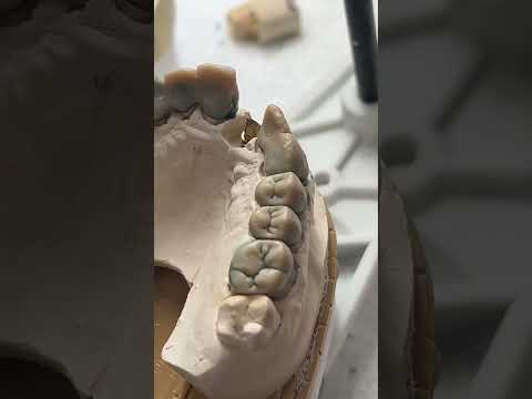 Full teeth anatomy !