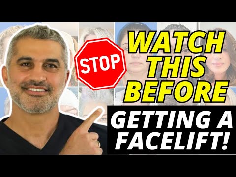 Considering a Facelift? EVERYTHING you need to know! The Beginner's Guide to Facelifts