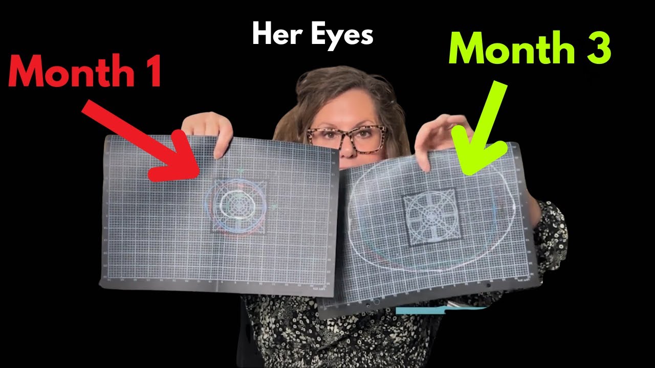 Increasing Functional Visual Field - Patient Case Report 2025