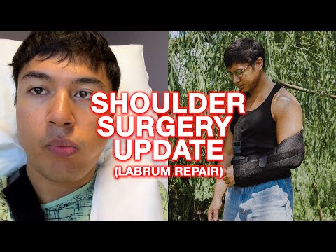 Labrum Surgery Recovery: Week 1-8 (What to Expect)