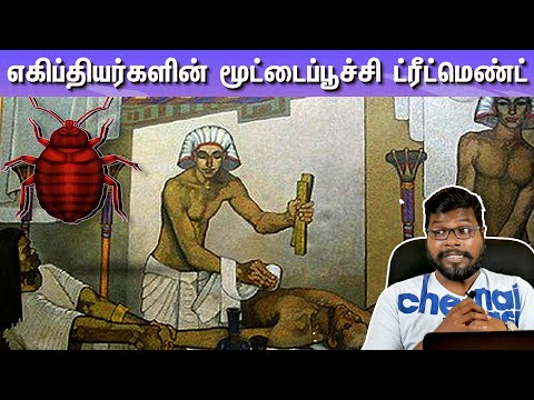 Unknown facts about Bedbugs |மூட்டைப்பூச்சி பற்றிய சூப்பர் தகவல்கள் |OU- EP 14| Big Bang Bogan
