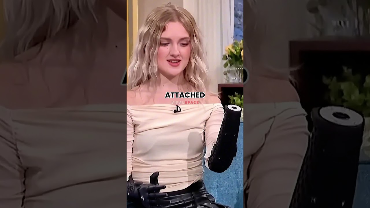 Bionic Arm Real-Life Demo