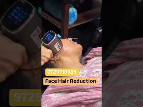 Laser Hair Removal for female Face | Laser Hair Reduction #laser #hairremoval