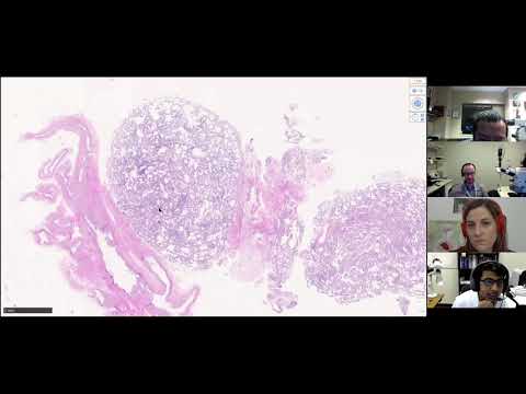Fresh Air with Sanjay and Matt: Episode 6: Lymphocytes in the Interstitium
