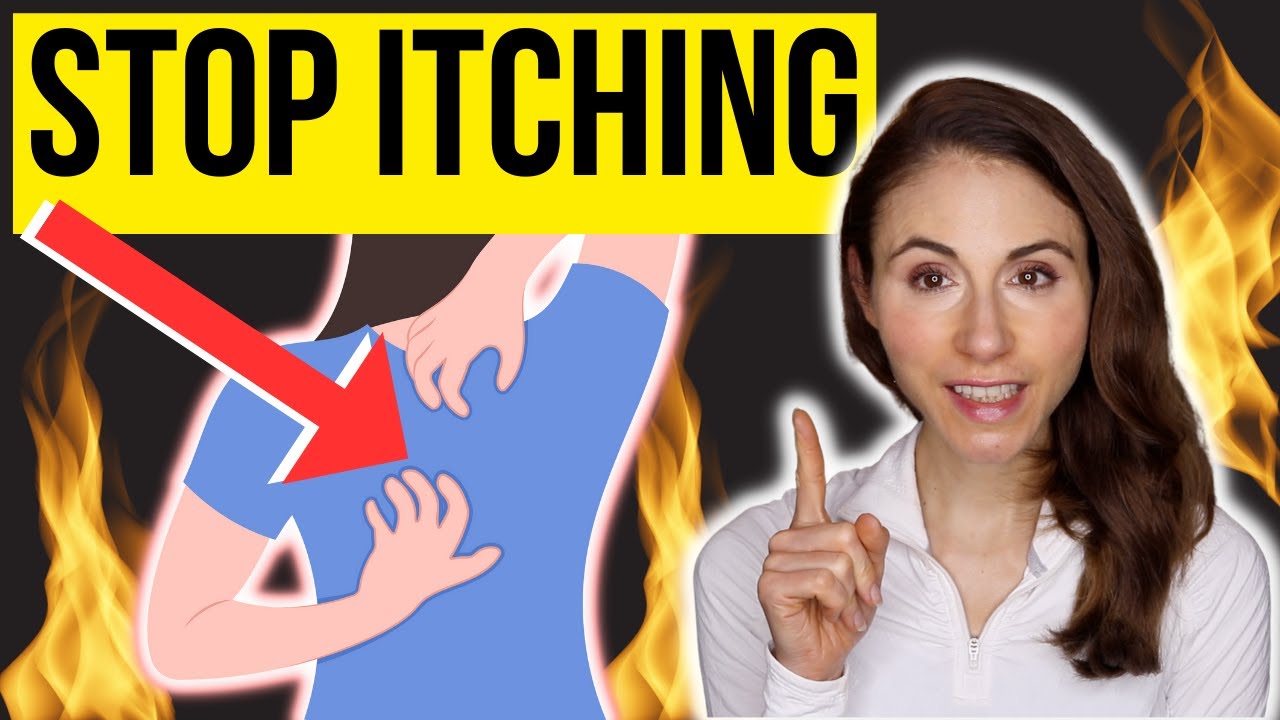 HOW TO STOP ITCHING ON THE BACK | Notalgia Paresthetica