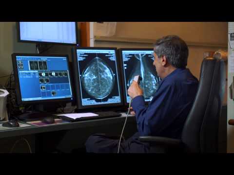 Fujifilm Digital Mammography - Aspire HD at BayView Radiology