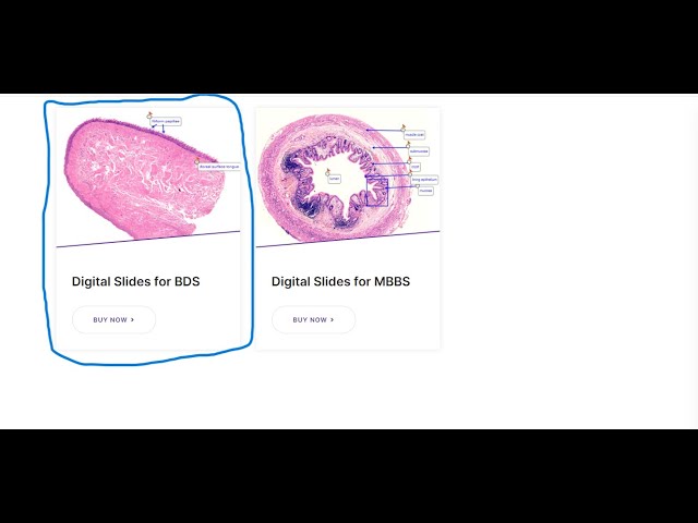 Prepared Microscope Slide Digital Oral Pathology - Oral Histology Face ...