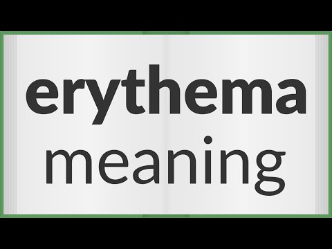 Erythema | meaning of Erythema