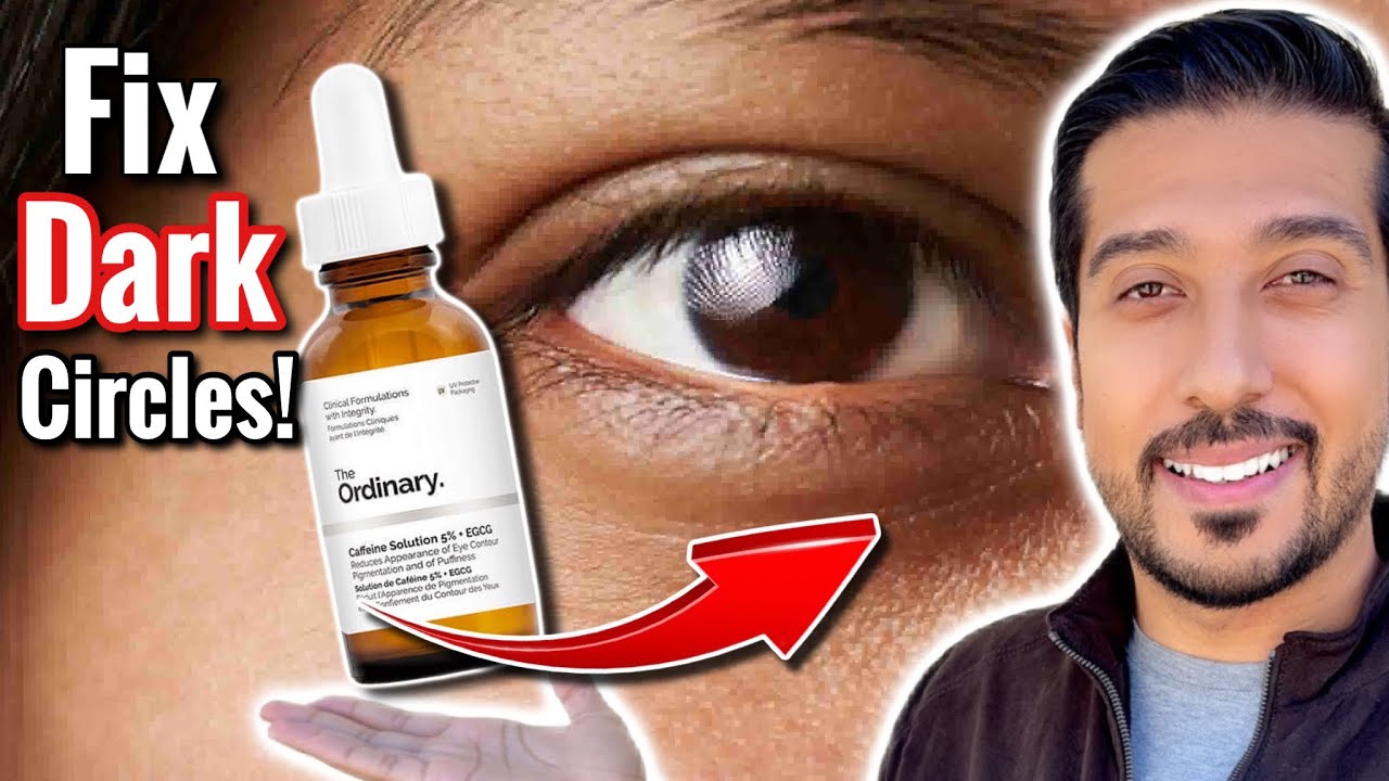 Get Rid of DARK CIRCLES and BAGS FAST! | The Ordinary Caffeine Serum