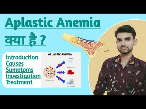 Aplastic Anemia in Hindi || Causes, Symptoms and Treatment of Aplastic Anemia