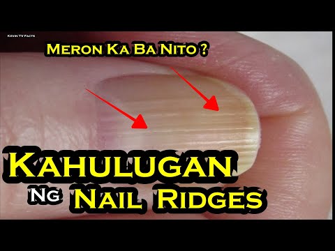 KAHULUGAN NG VERTICAL NAIL RIDGES- MERON KA BA NITO ALAMIN ANG IBIG SABIHIN