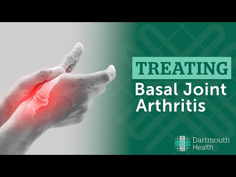 Basal Joint Arthritis