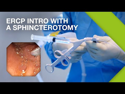 Olympus ERCP | ERCP Practical Guide | Part 1: Introduction with a Sphincterotomy | Gastroenterology