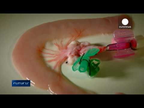 The fascinating science behind tailor-made bones - Futuris