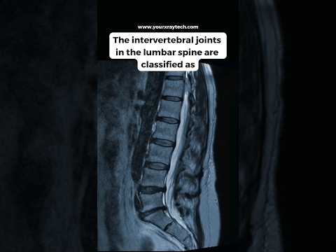 Lumbar Spine Anatomy @YourXRayTech 🖤🩻 #anatomy #radtech #instructor
