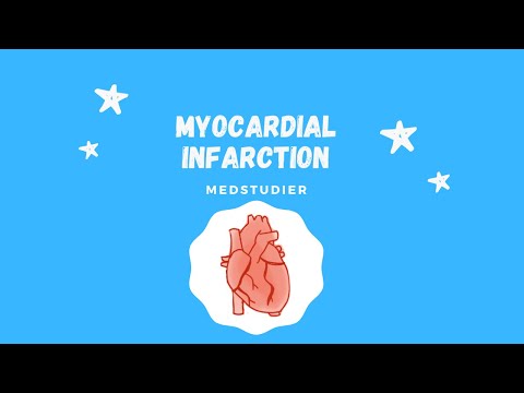 Myocardial Infarctions | MedStudier