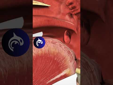 See what Strep Throat looks like in 3D 🦠