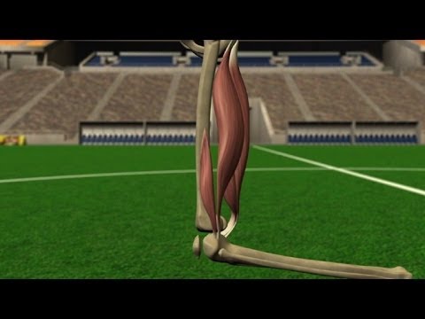 Comment soigner une elongation ischio jambier ? La réponse est sur ...