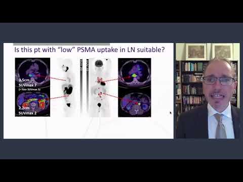 Do we need the second PET (FDG) for patient selection? (including SUV for selection of PSMA therapy)