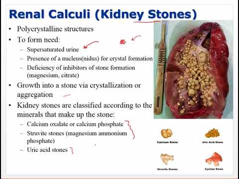 Ch 30 Urinary and Renal Disorders