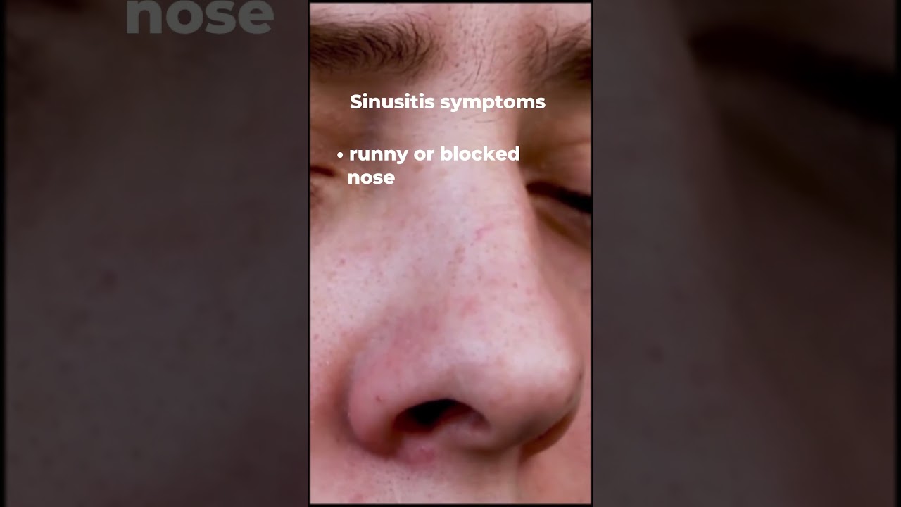 Pharmacy First - Sinusitis || Pearl Chemist Group