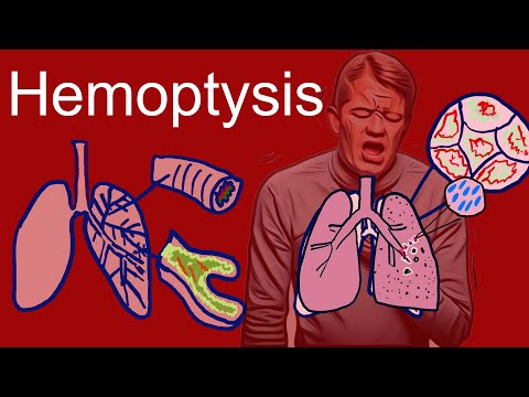 Hemoptysis (Coughing Up Blood) - Causes, types, symptoms