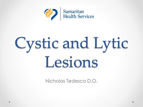 Tedesco - Cystic & Lytic Lesions