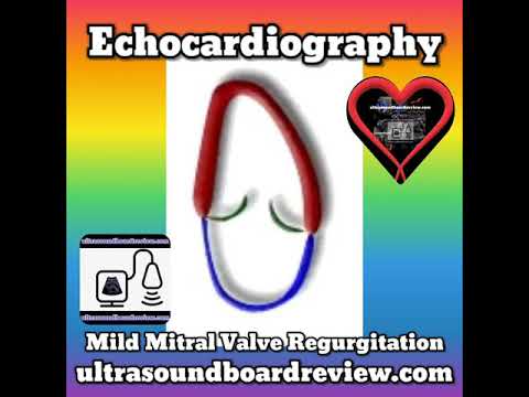 Mild Mitral Valve Regurgitation