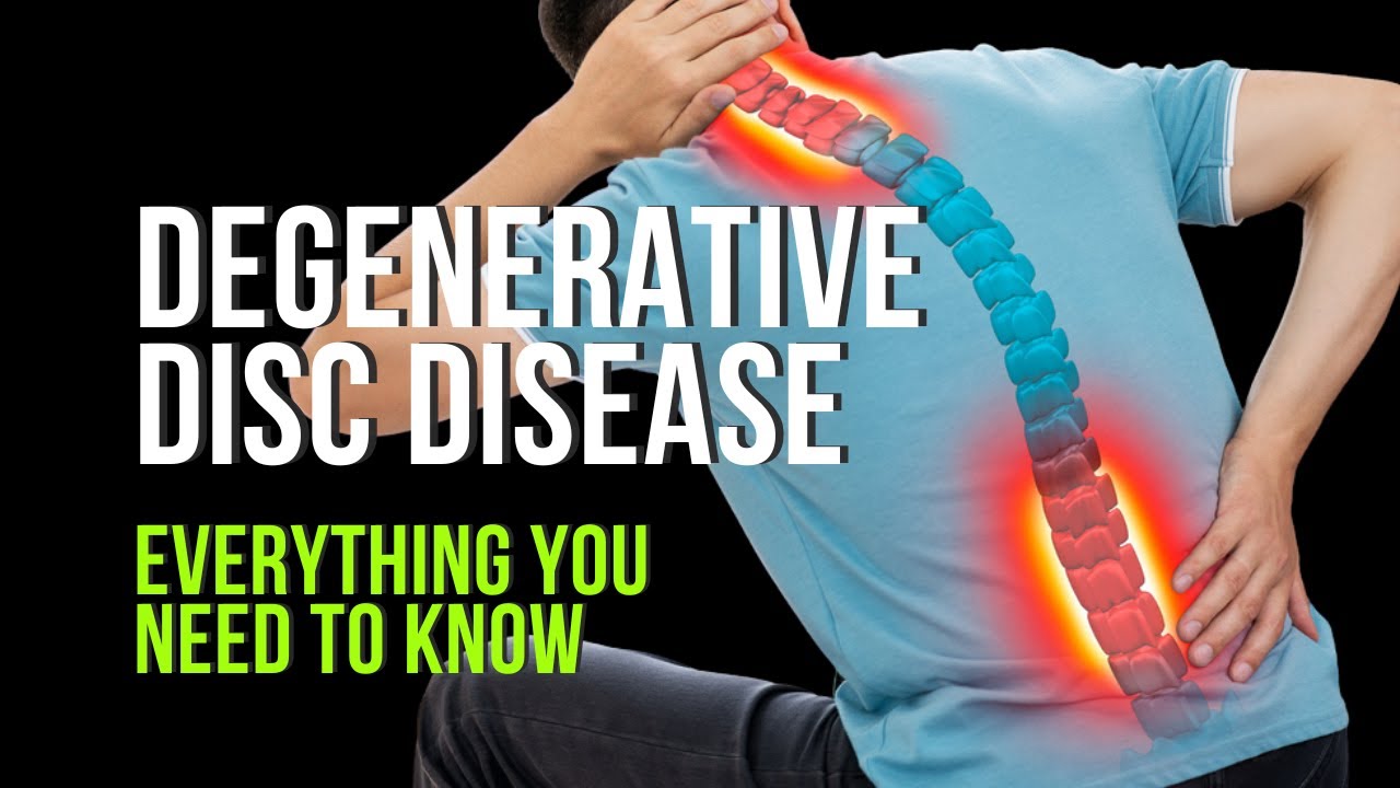 Degenerative Disc Disease Explained for Everyone!