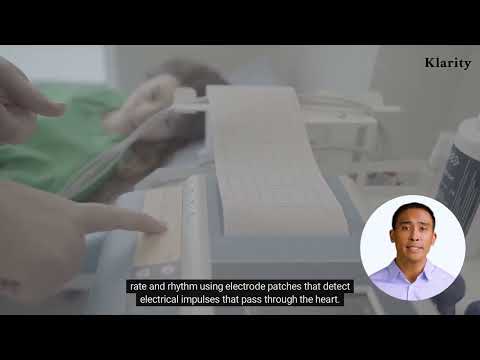 Echocardiogram vs Electrocardiogram