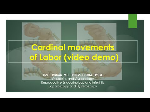 Cardinal Movements of Labor – Doc Ina Ob Gyne