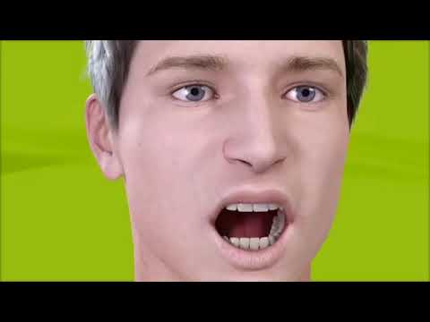 Straumann Implant borne multi tooth treatment