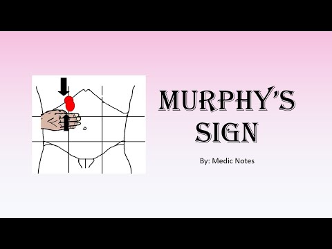 Murphy's sign pathophysiology