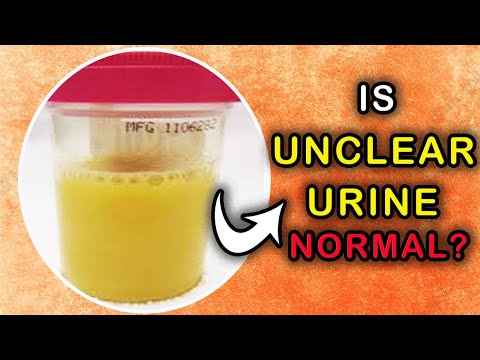 CLOUDY URINE: What Causes Unclear or Milky Urine