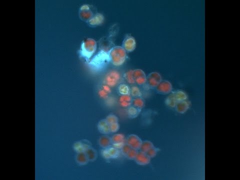 Episode 3B – Hay Infusion/Dark Field – Backyard Microscope