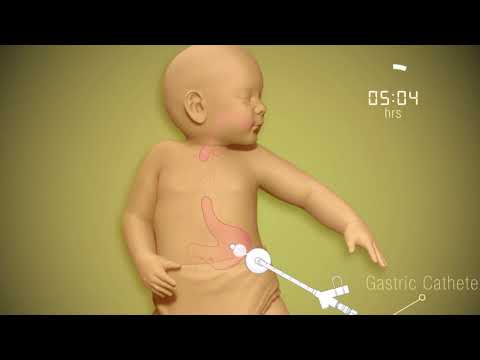 FIRECREST Medical Device