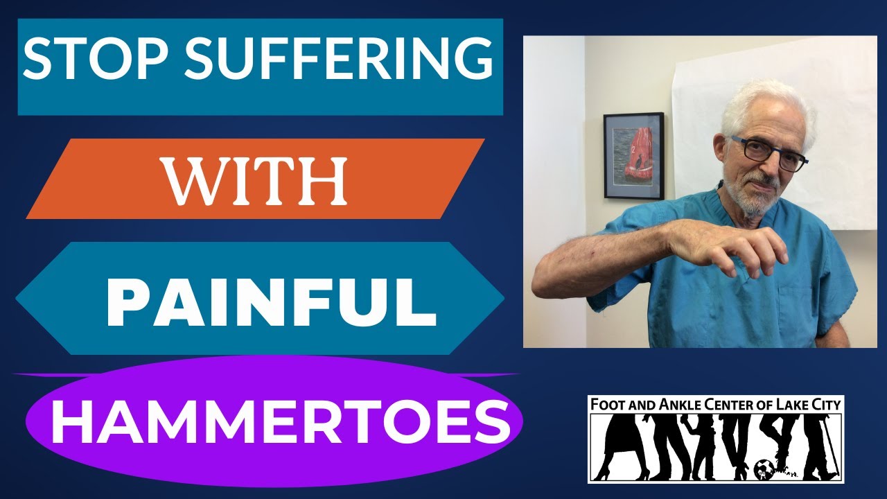 Relieve Your Hammertoe Pain Now! | Foot and Ankle Center of Lake City
