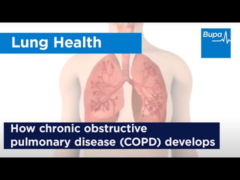 How chronic obstructive pulmonary disease (COPD) develops | Bupa Health