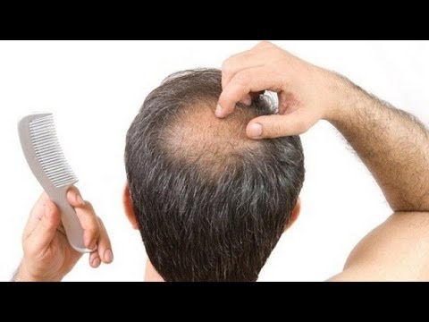 Comment guerir la teigne chez l'homme ? La réponse est sur Admicile.fr