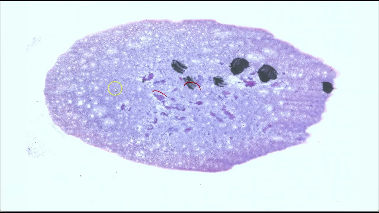 Cytology - Reactive lymph node
