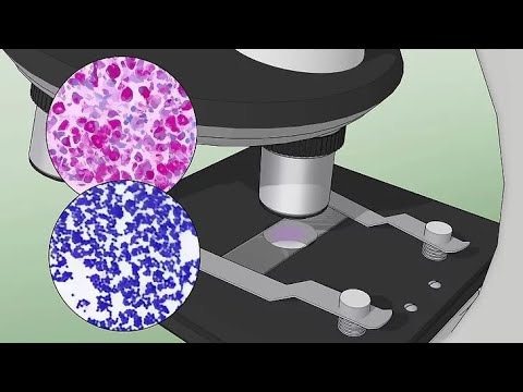 Commensal bacteria and infection