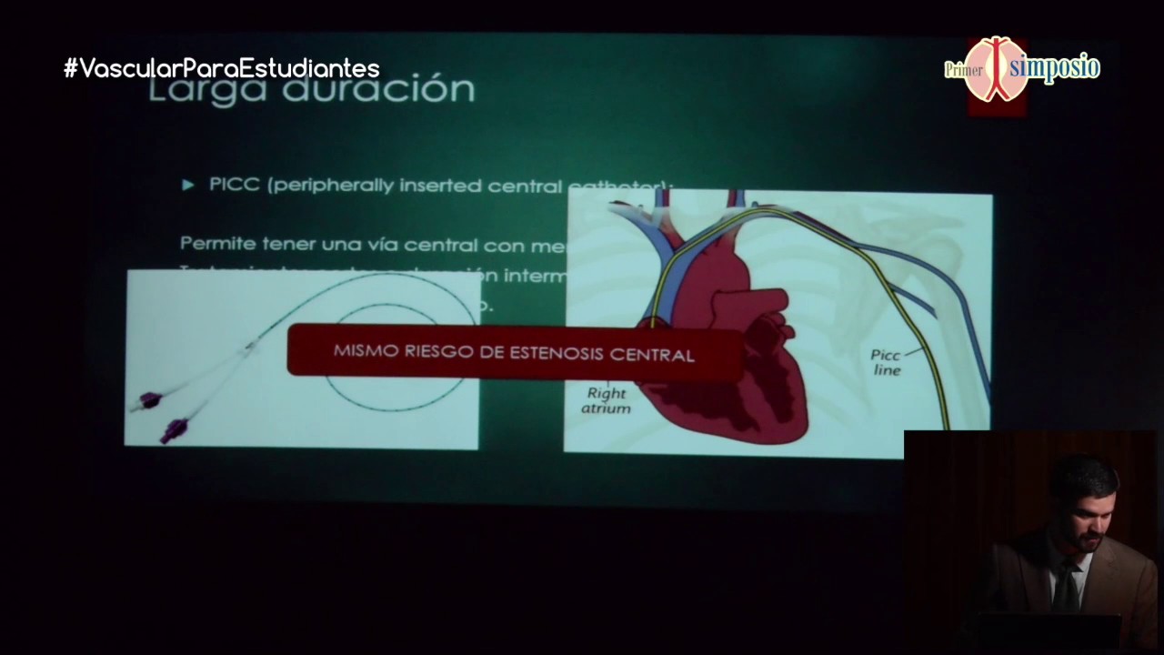 20) Tipos de catéteres - Dr. Marlon Lacayo Valenzuela (HGM)