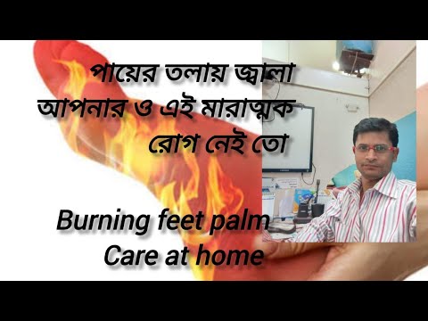 Burning feet palm care at home #physiotherapy treatment for burning feet palm
