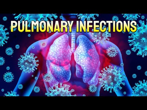 Pneumonia and Respiratory Infections (updated 2023) - CRASH! Medical Review Series