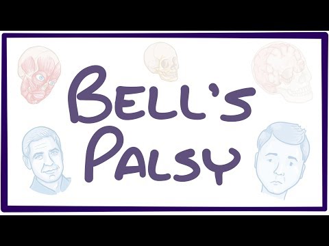 Bell’s Palsy – causes, symptoms, diagnosis, treatment, pathology ...