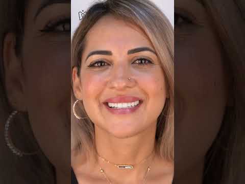 A Dentakay smile makeover can change your whole appearance…
