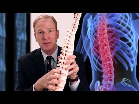 Spinal Nerve Root Pain