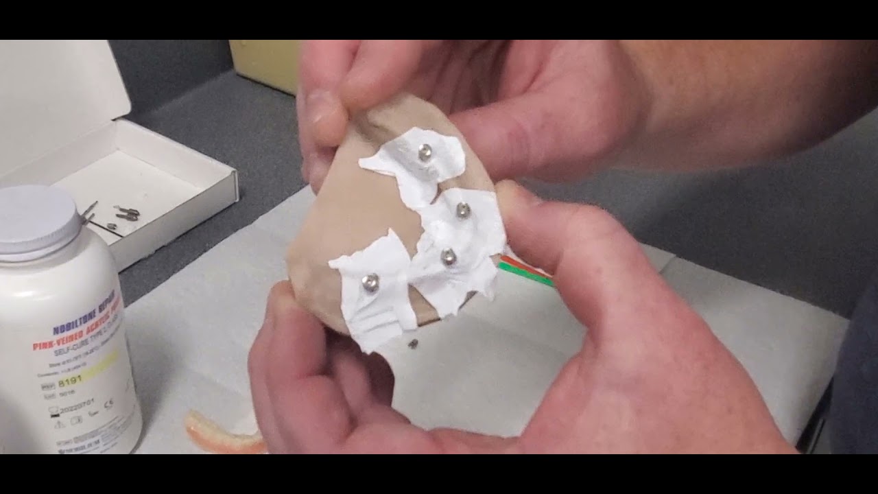 Simplifying Full Arch Prosthetics with the Smart Denture Conversion Kit