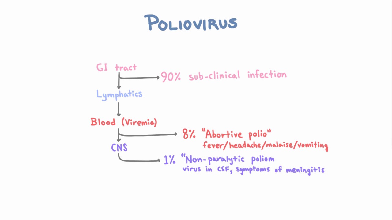 Polio - Clinical Presentations